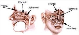 Pansinusitis - What is?, Treatment, Surgery, Symptoms, Acute