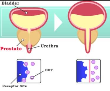 What is Nocturia? Definition, Causes, Treatment & Diagnosis